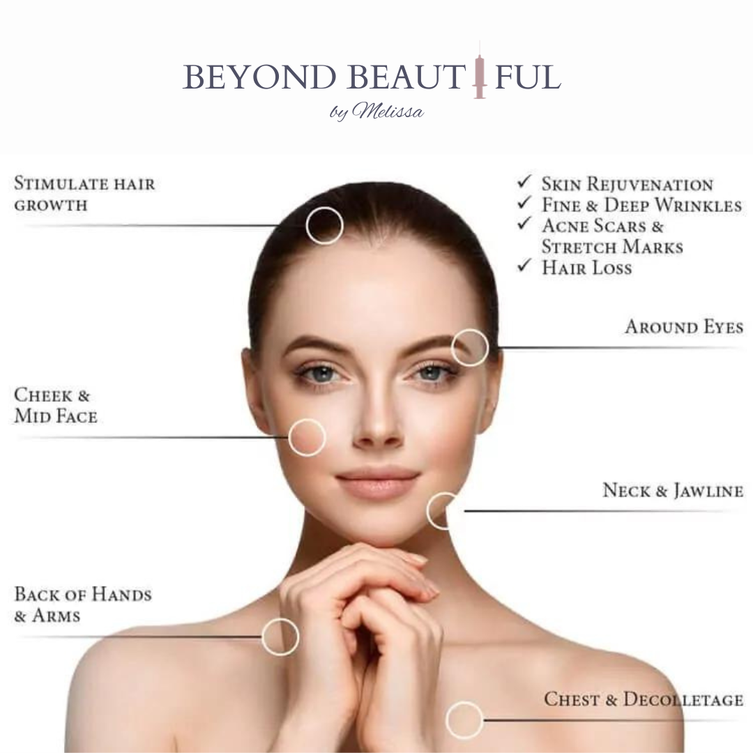 PRP Therapy - Beyond Beautiful By Melissa